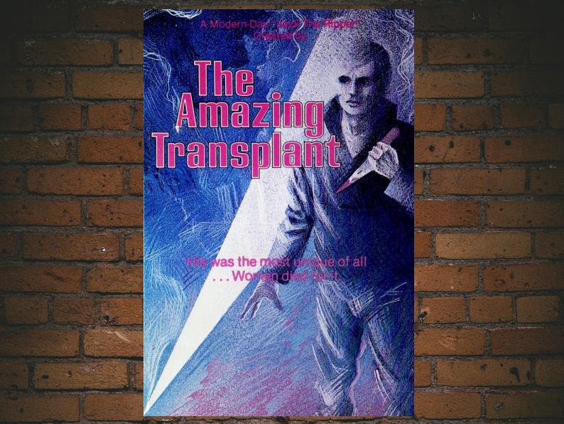 -The Amazing Transplant (1970)-The Original Movie - ClassicsOnPoint.com